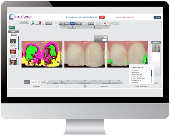 ShadeWave Dental Shade Matching Software