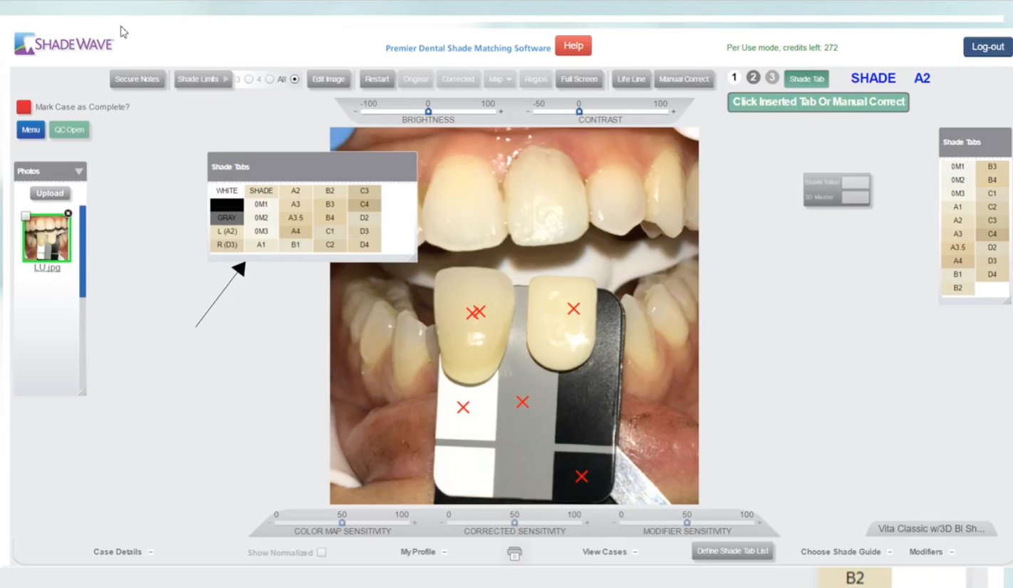 ShadeWave Issued US Patent-Dental Shade Map Matching Technology