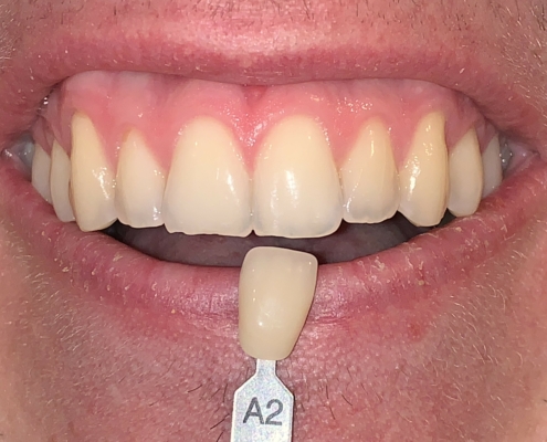 ShadeWave Dental Shade Matching Software