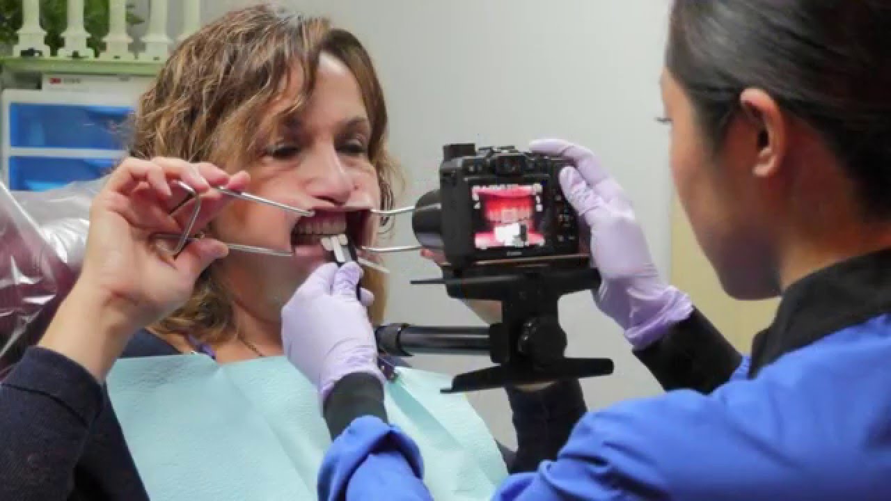 ShadeWave Launches Next-Generation Shade Matching System - ShadeWave